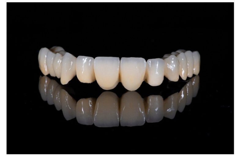 Human Teeth: Types, Anatomy, Dental formula and Importance of Teeth